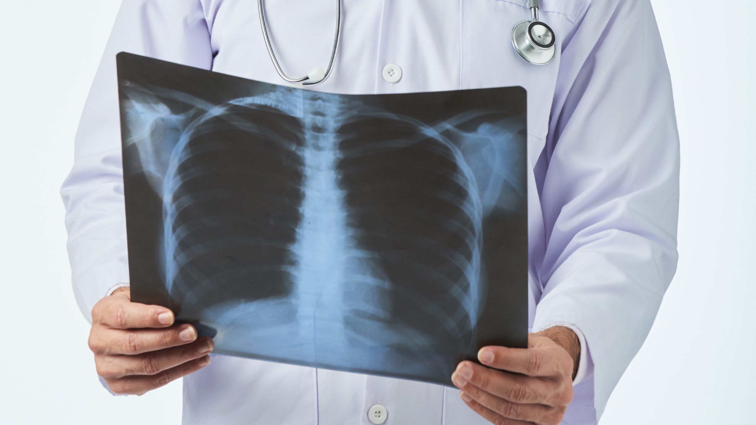 Radiologija - Kalmedika by Health Express